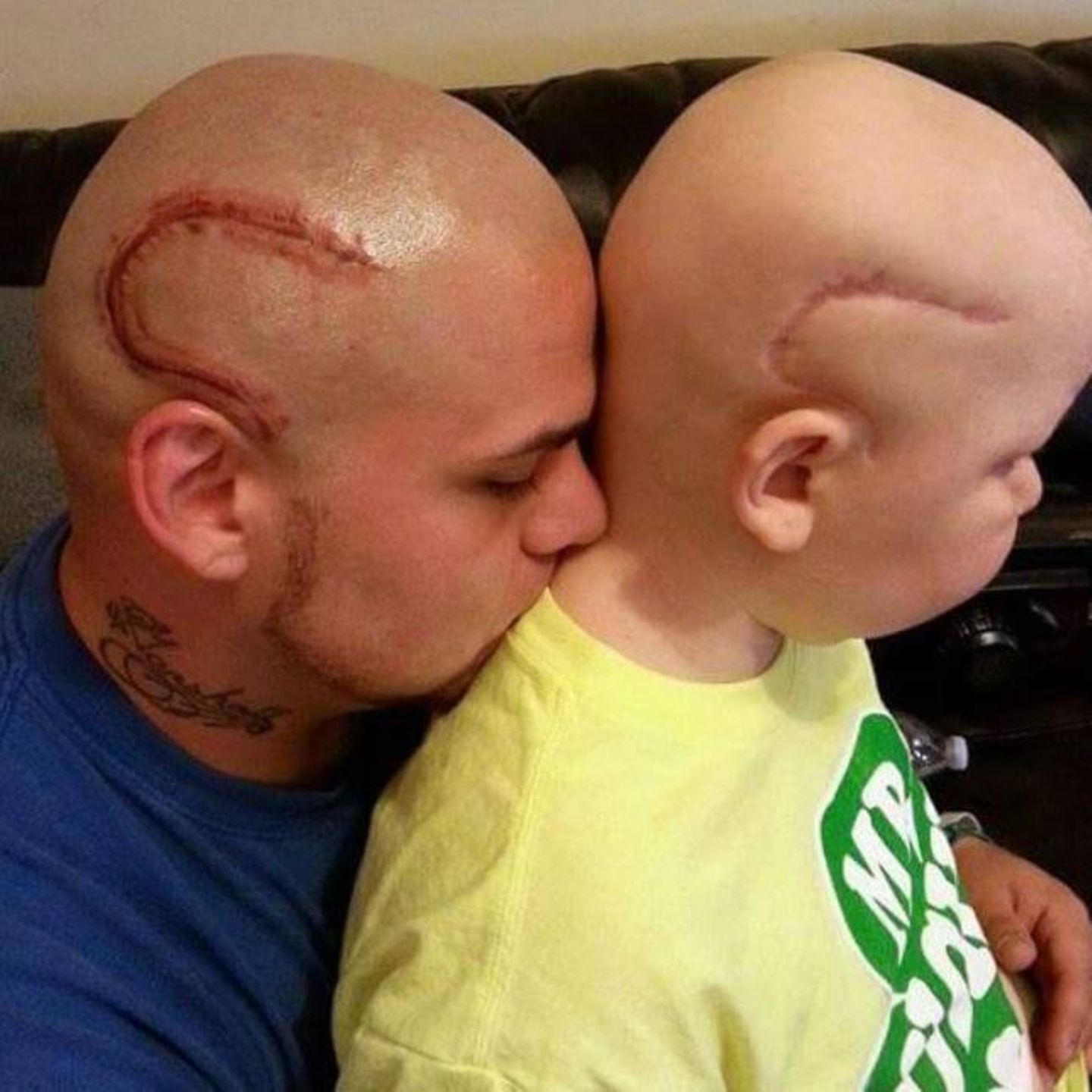 Narbe Kaiserschnitt Tattoos