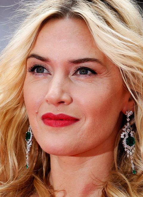 Schönheitsflecken: Mit Makeln schön | GALA.de