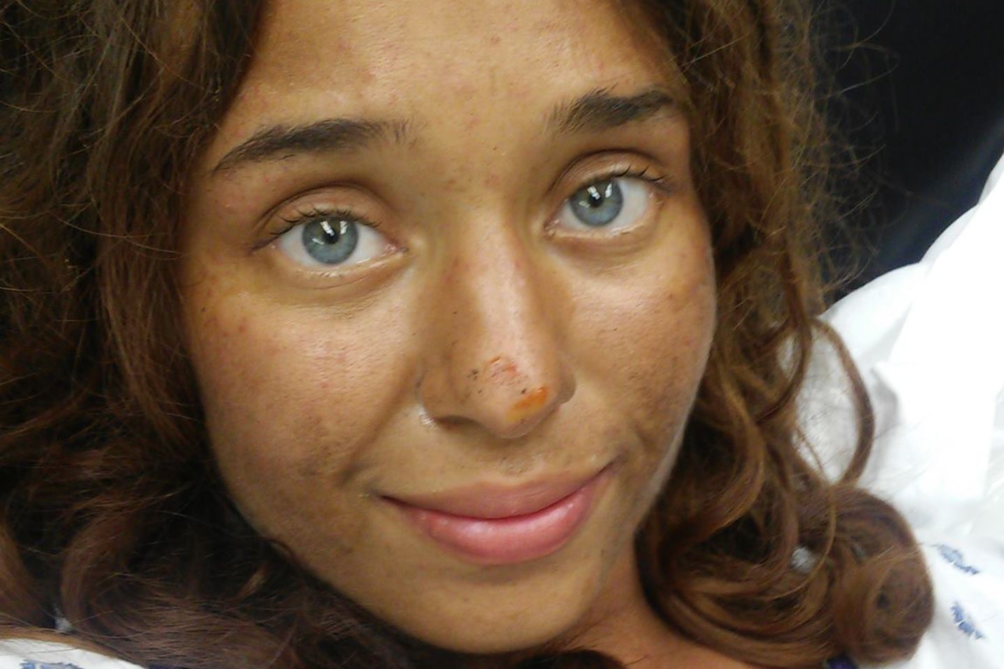 Unglaublich: Frau überlebt 28 Tage alleine im Wald | GALA.de