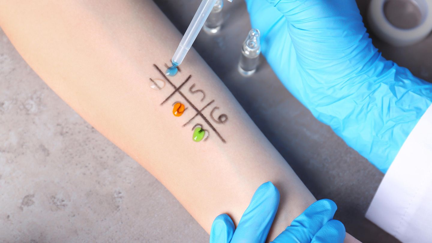 Allergietest: Bin ich allergisch? | GALA.de