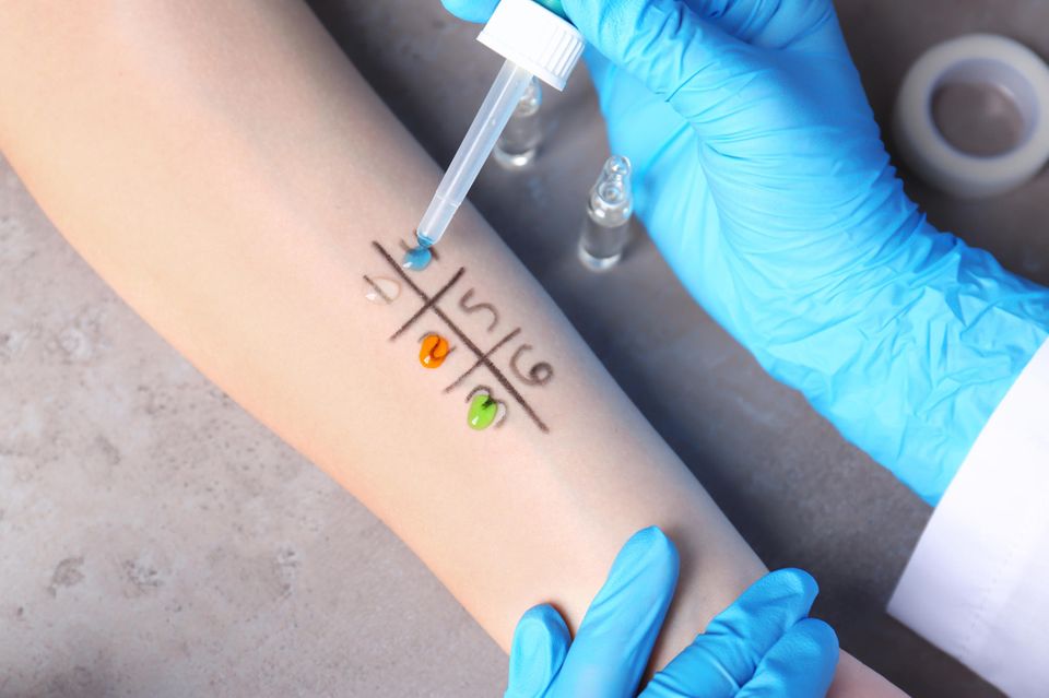 Allergietest: Bin ich allergisch? | GALA.de