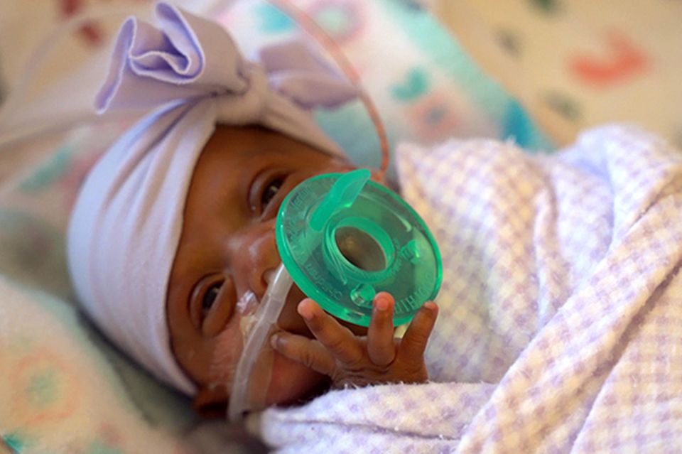 Kleinstes Frühchen der Welt: Baby Saybie wurde mit nur 245 g geboren ...