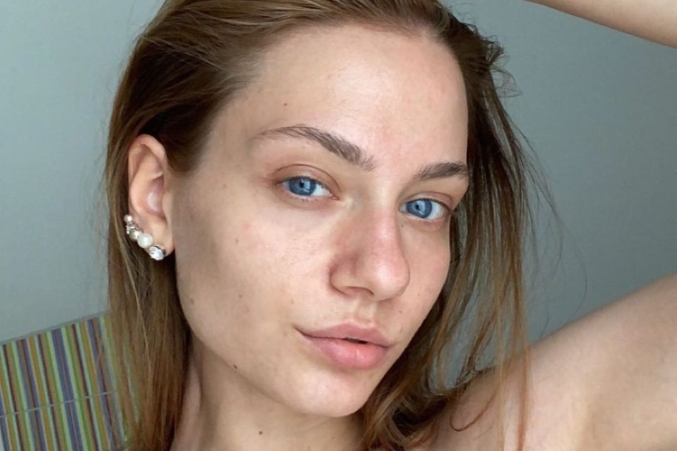 Germany's next Topmodel: Vivian erhielt mit neun die Diagnose ...