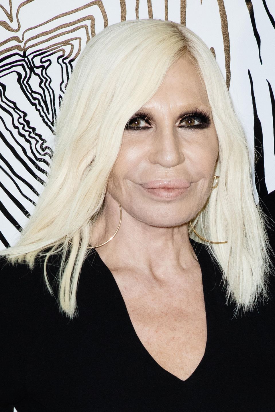 Botox und Schönheits-OPs: Stars im Schönheitswahn | GALA.de