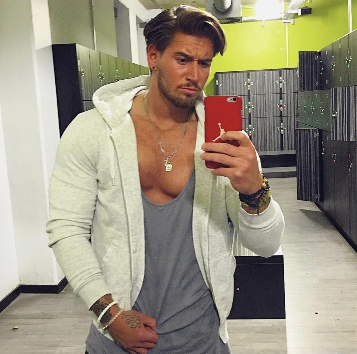 Dschungelcamp 2024: So sehr haben sich die Kandidaten optisch verändert ...