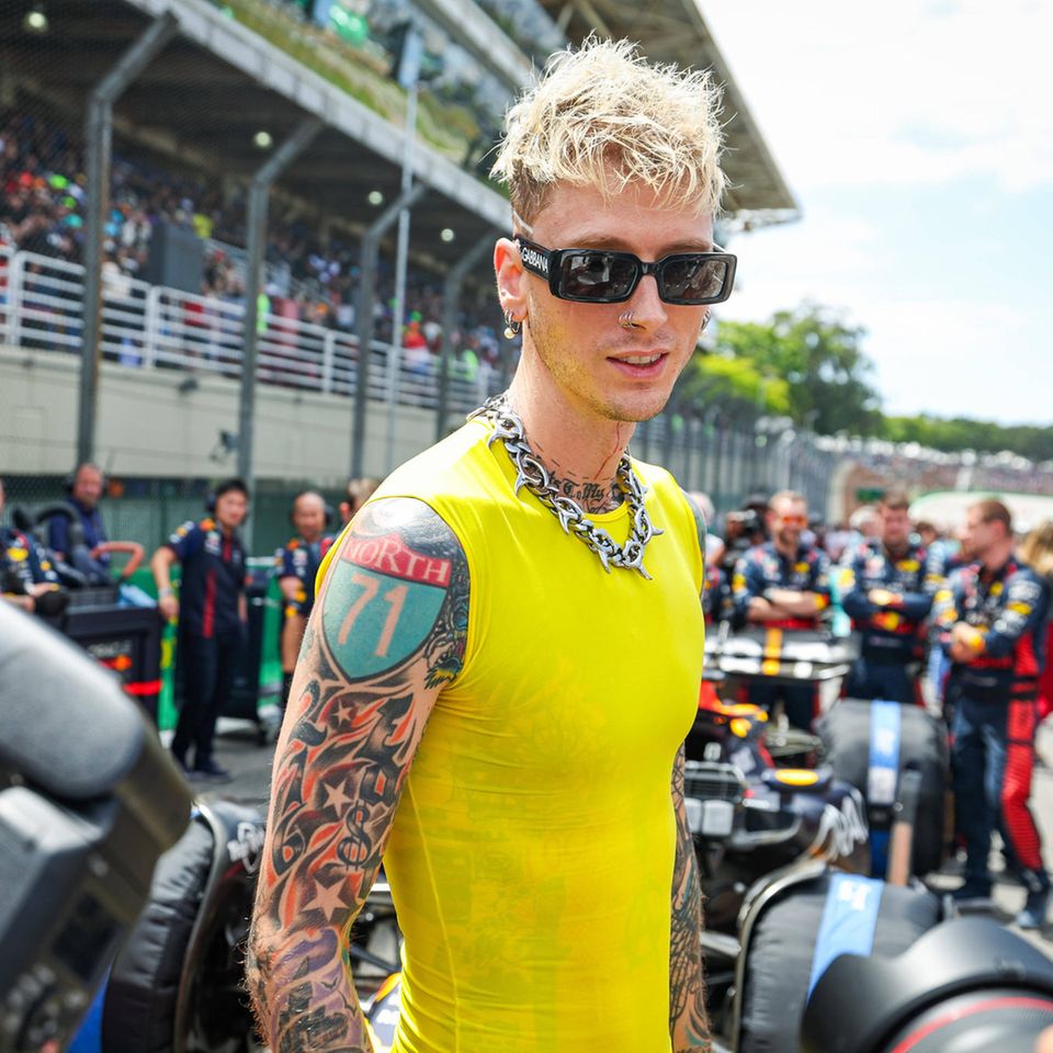 Strahlendes Lächeln: So wird's weißer | GALA.de