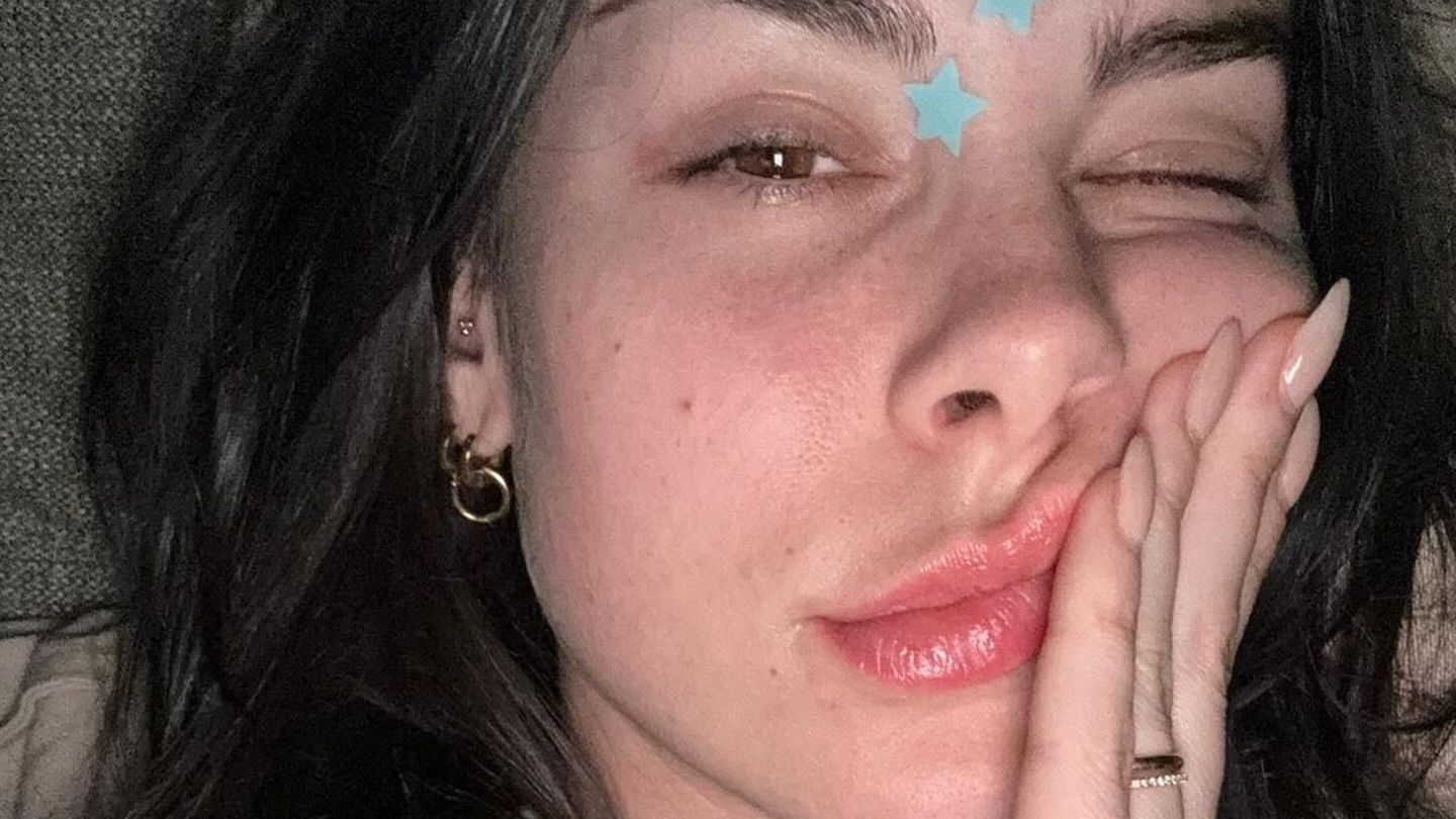 Body Positivity: Diese Stars lieben ihre einzigartigen Körper | GALA.de