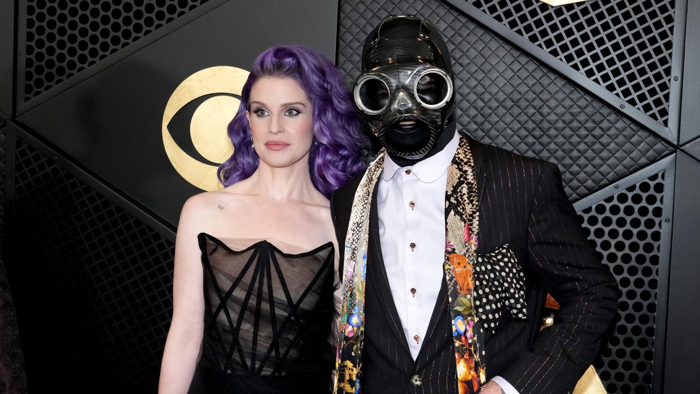 Sid Wilson meldet sich nach Explosion zurück: "Gesicht geschmolzen ...