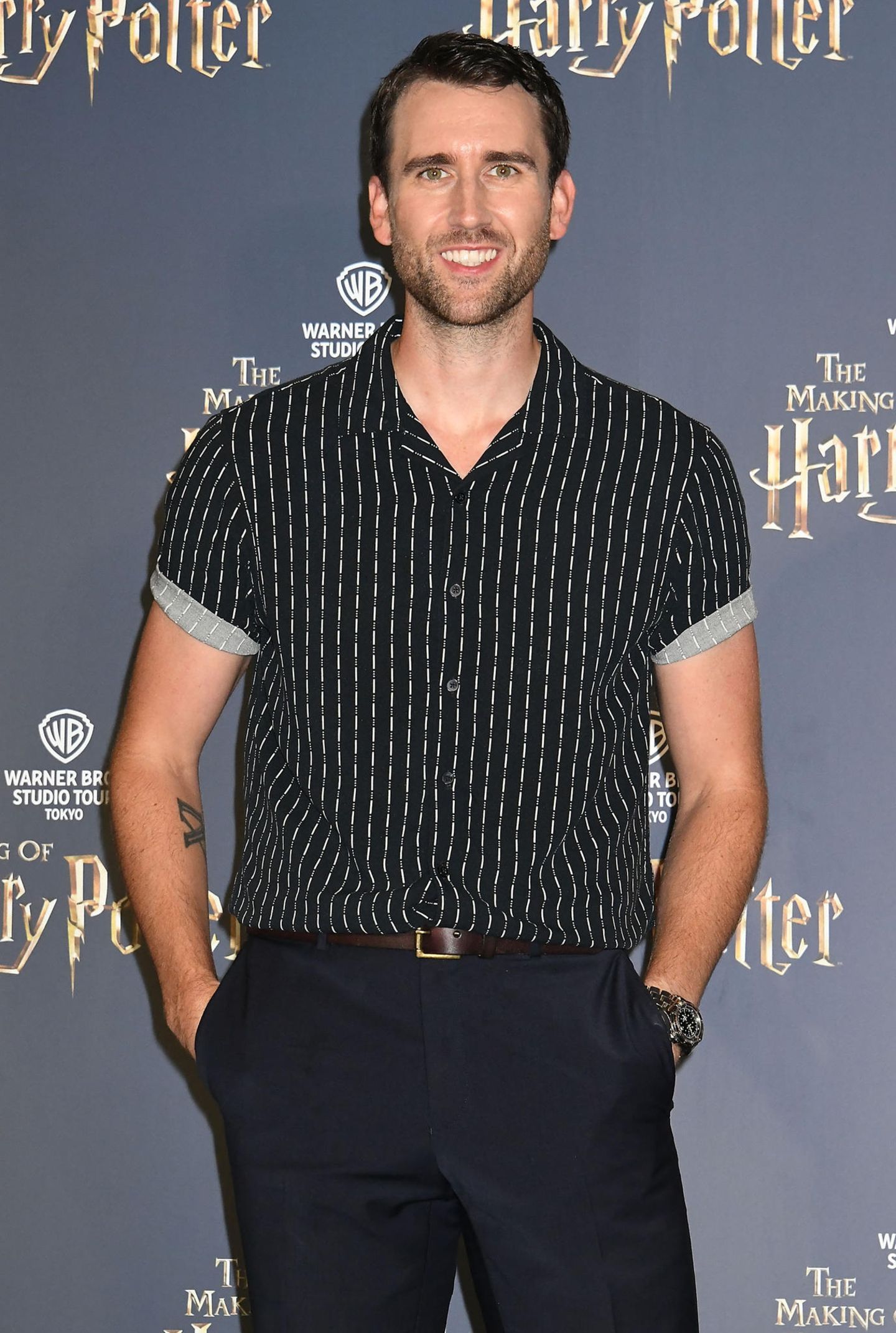 Matthew Lewis Vriendin Matthew Lewis Zähne Perfektes Makeover