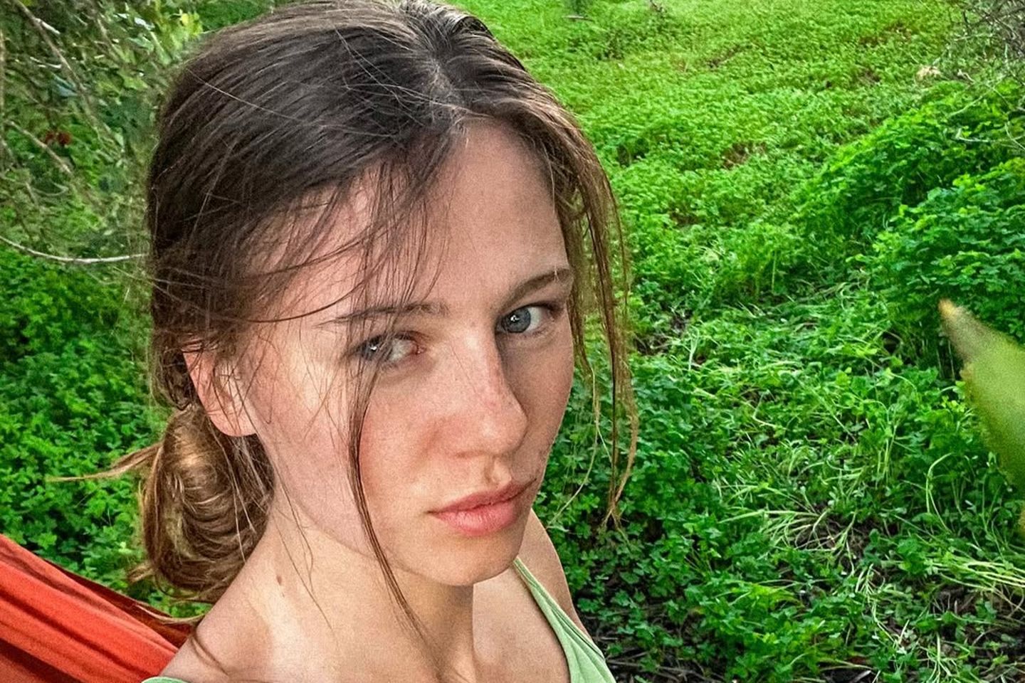 Ann-Kathrin Bendixen nach OP frustriert: "Als hätte ich ein Holzbein" | GALA.de