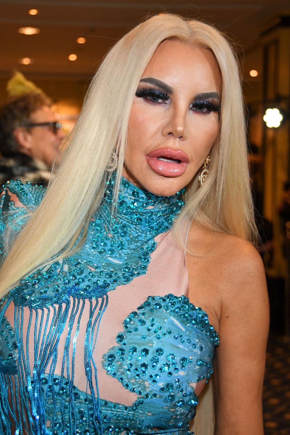 Botox und Schönheits-OPs: Stars im Schönheitswahn | GALA.de