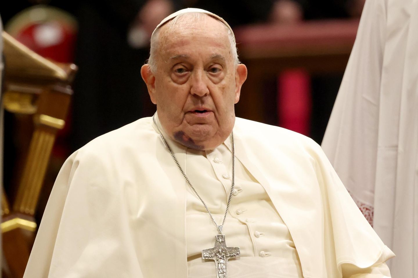 Papst Franziskus: Vatikan veröffentlicht erstes Foto aus Klinik | GALA.de