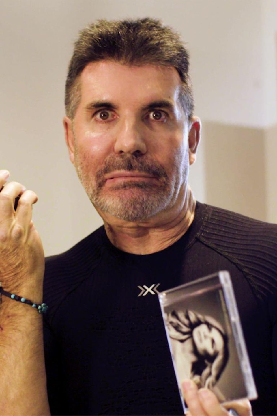 Botox und Schönheits-OPs: Stars im Schönheitswahn | GALA.de