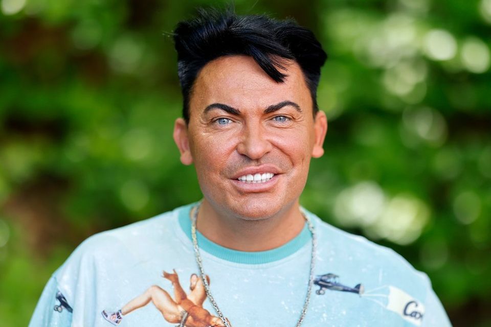 Matthias Mangiapane: Reality-Star hat 25 Kilogramm abgenommen | GALA.de