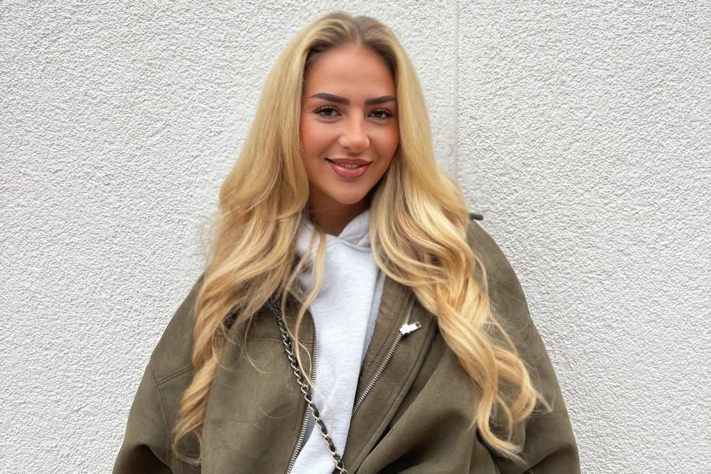 Emma Fernlund: "Sommerhaus"-Star schockt nach OP-Marathon mit komplett ...