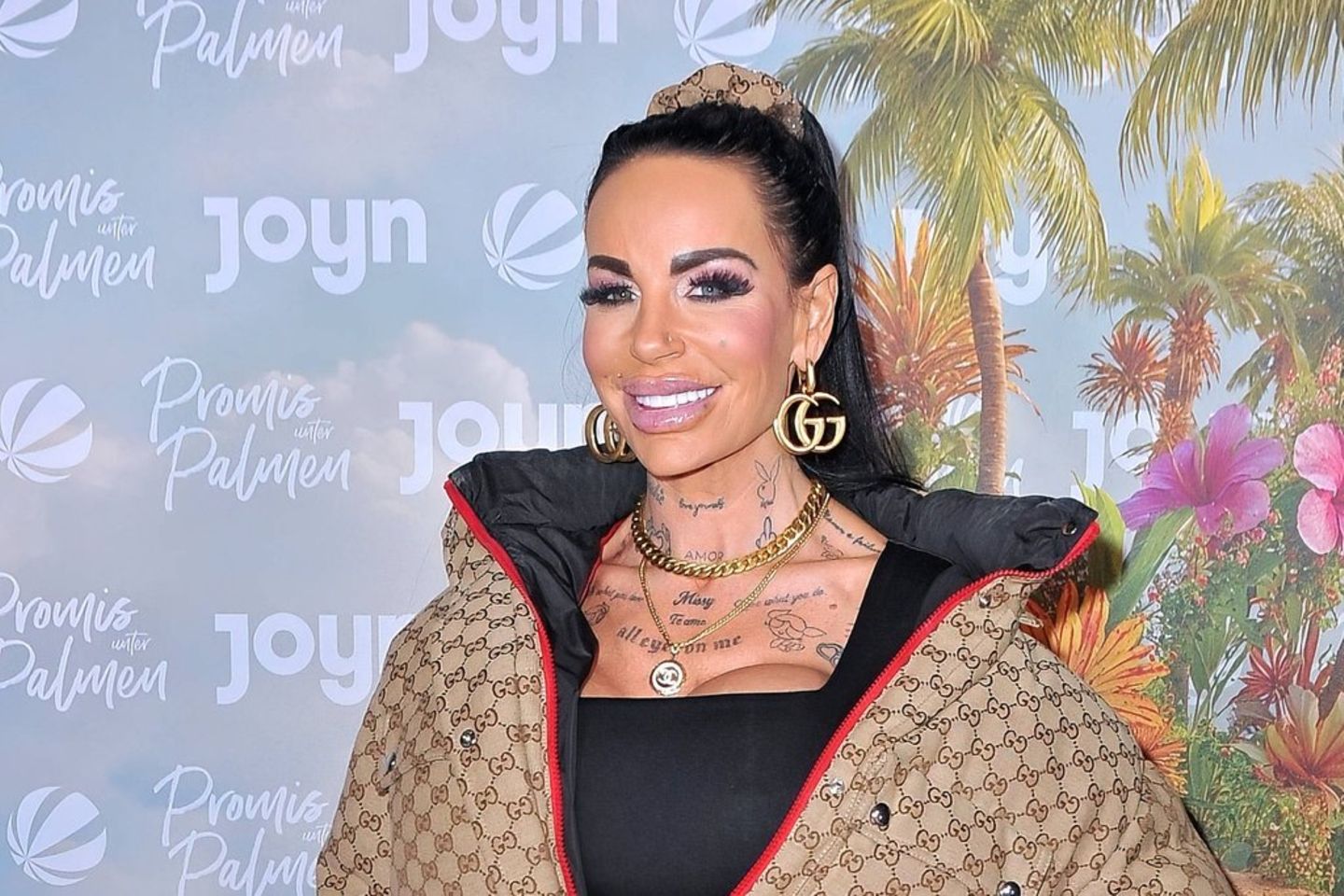 Gina-Lisa Lohfink: Reality-Star hat Angst um Bein | GALA.de